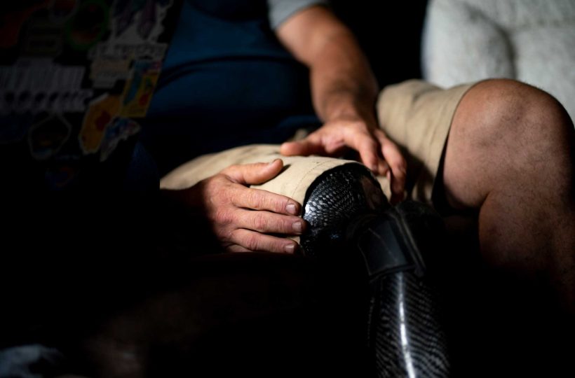 Amputee Veterans Face Chronic Lack of VA Care, Prosthetics - The War Horse